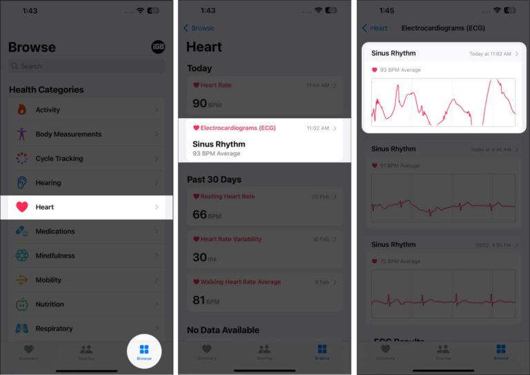 How to use ECG on Apple Watch: A complete guide – iGeeksBlog