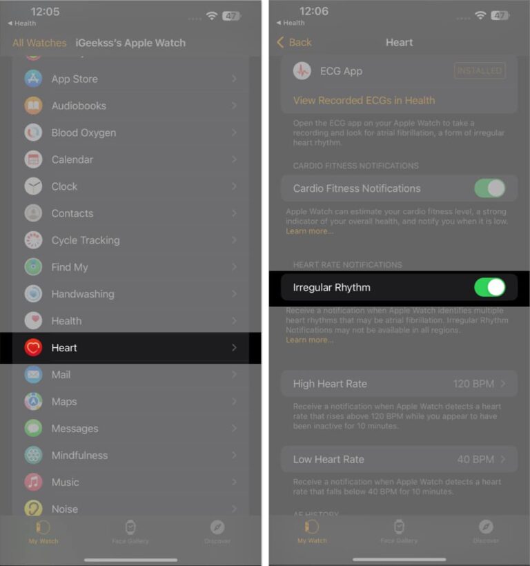 How to use ECG on Apple Watch: A complete guide – iGeeksBlog