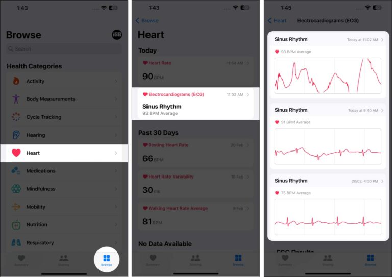 How to use ECG on Apple Watch: A complete guide – iGeeksBlog