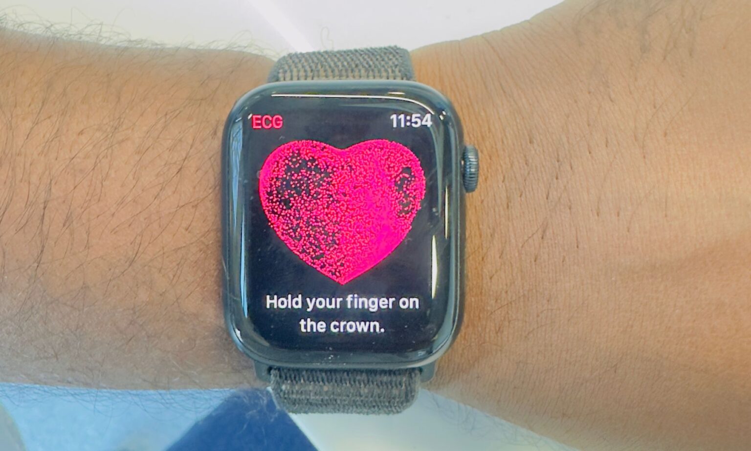 ECG not working on your Apple Watch? Here's how to fix it